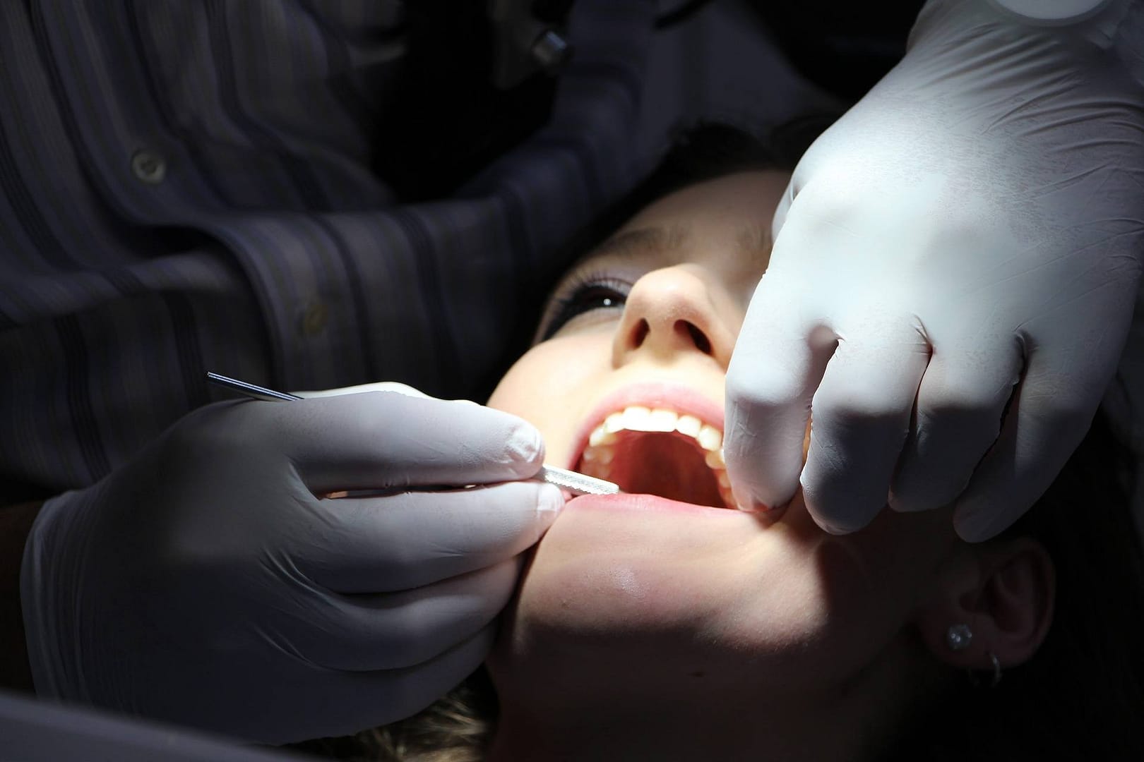 Agonizing Gum Surgery – Are These 4 Types Really Necessary?