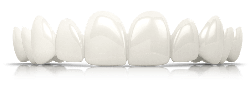 Instasmile Alternative with BilVeneers by Brighter Image Lab