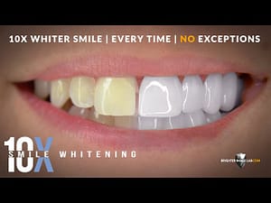 Video Gallery Featuring Brighter Image Lab Clients and Products ...