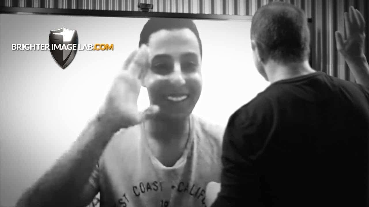 Broken Teeth Problem in Africa Gets Smile Makeover - PressOn Veneers ...