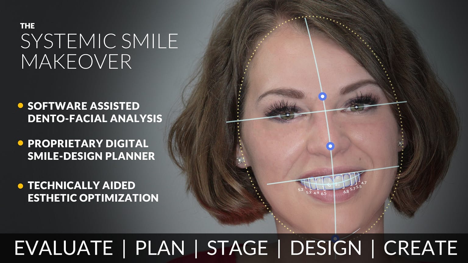 Instant Smile Veneers | 5 New Things To Look Out For