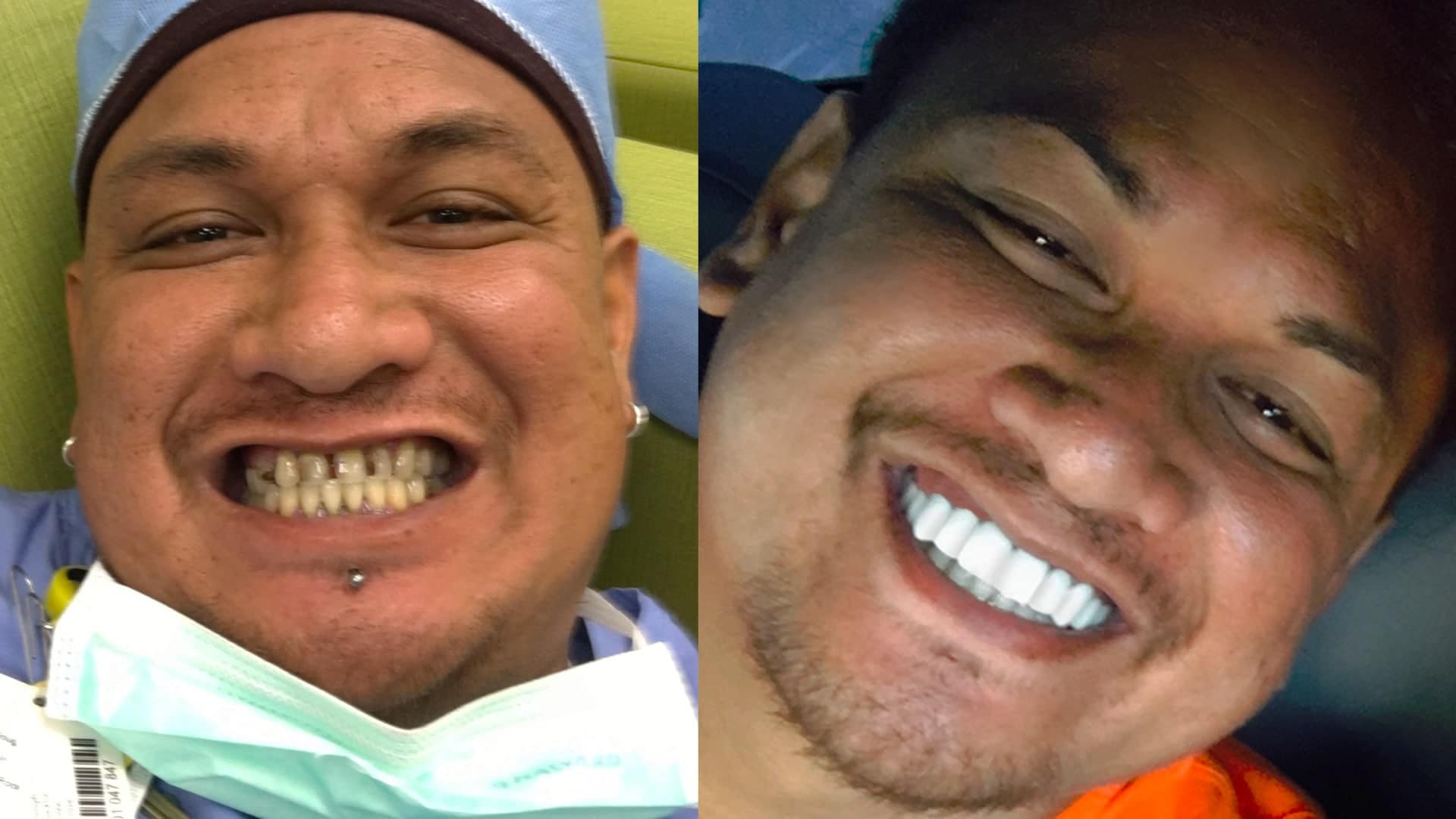 Inspiring 8 Minute Hawaii Smile Makeover