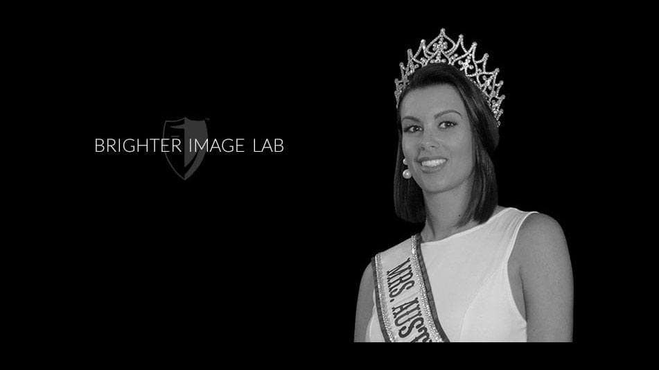 Pageant Queen Gets Dazzling Smile With Incredibil Veneer - PressOn ...